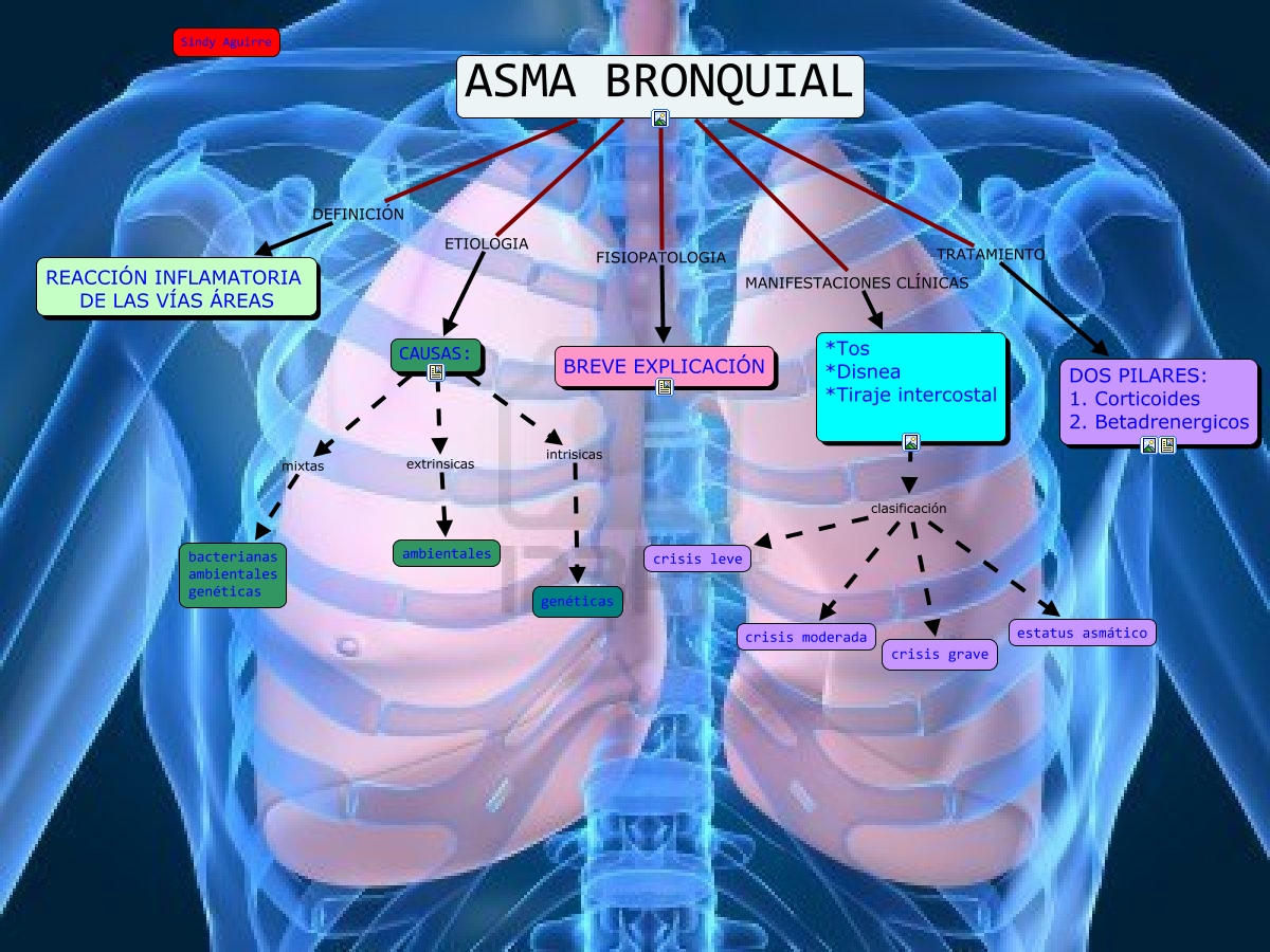 ASMA BRONQUIAL SINDY AGUIRRE