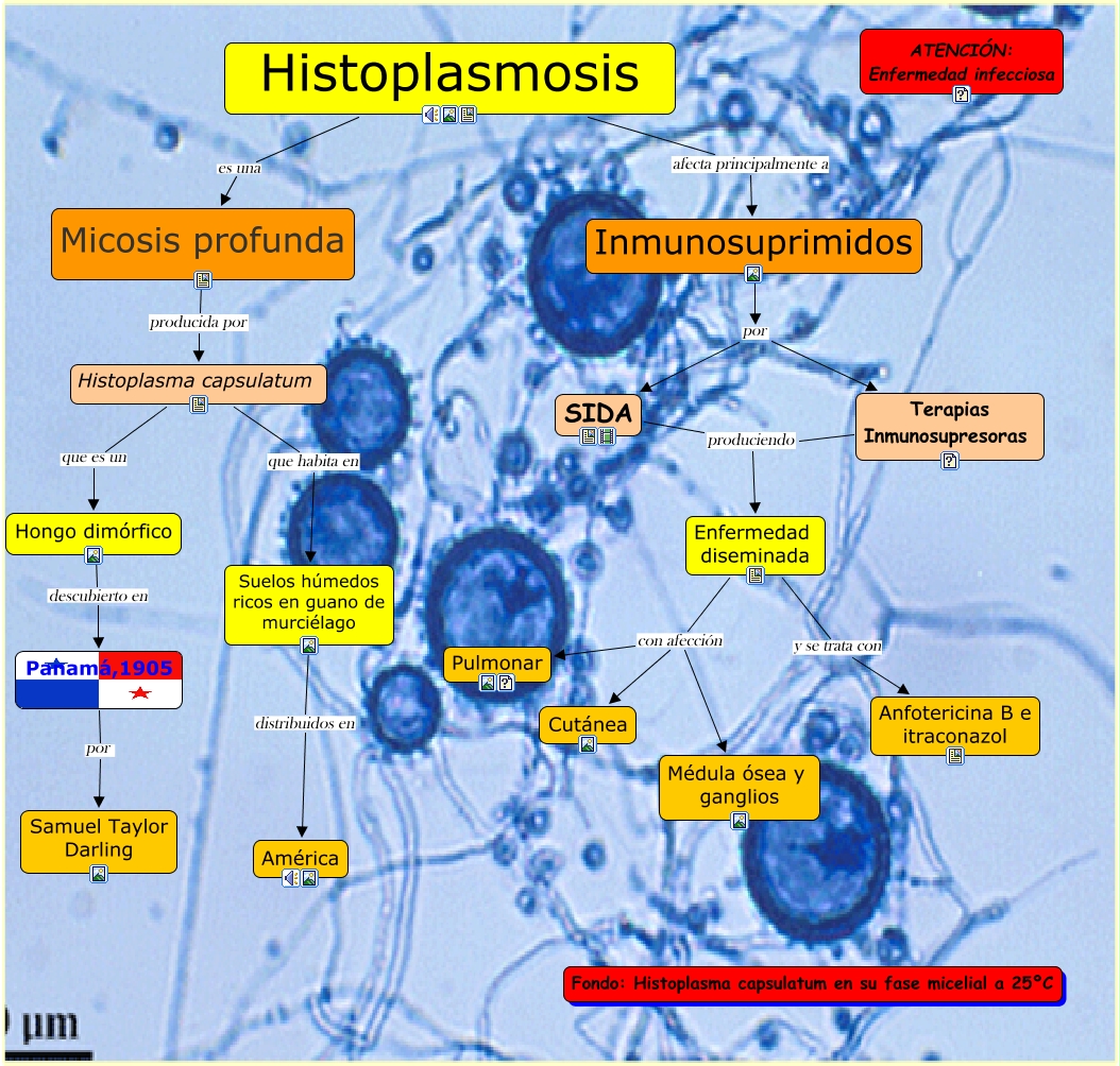 Histoplasmosis.cmap - ¿Qué es la histoplasmosis?