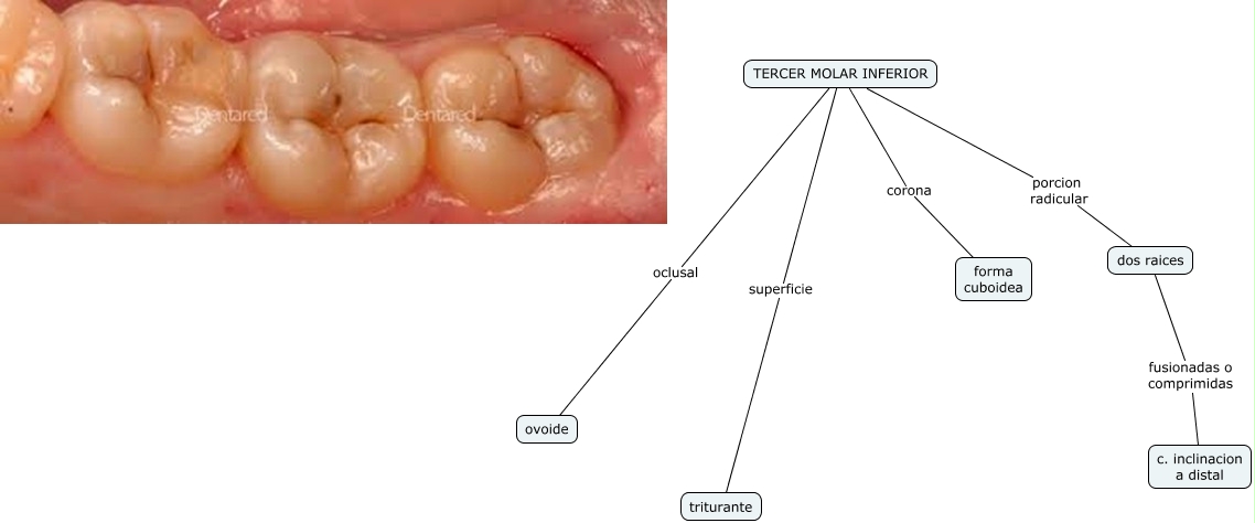 TERCER MOLAR INFERIOR